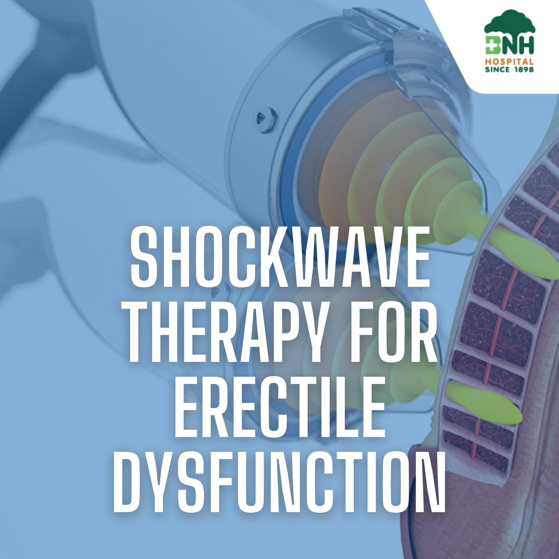 Shockwave therapy for Erectile Dysfunction - The M BRACE